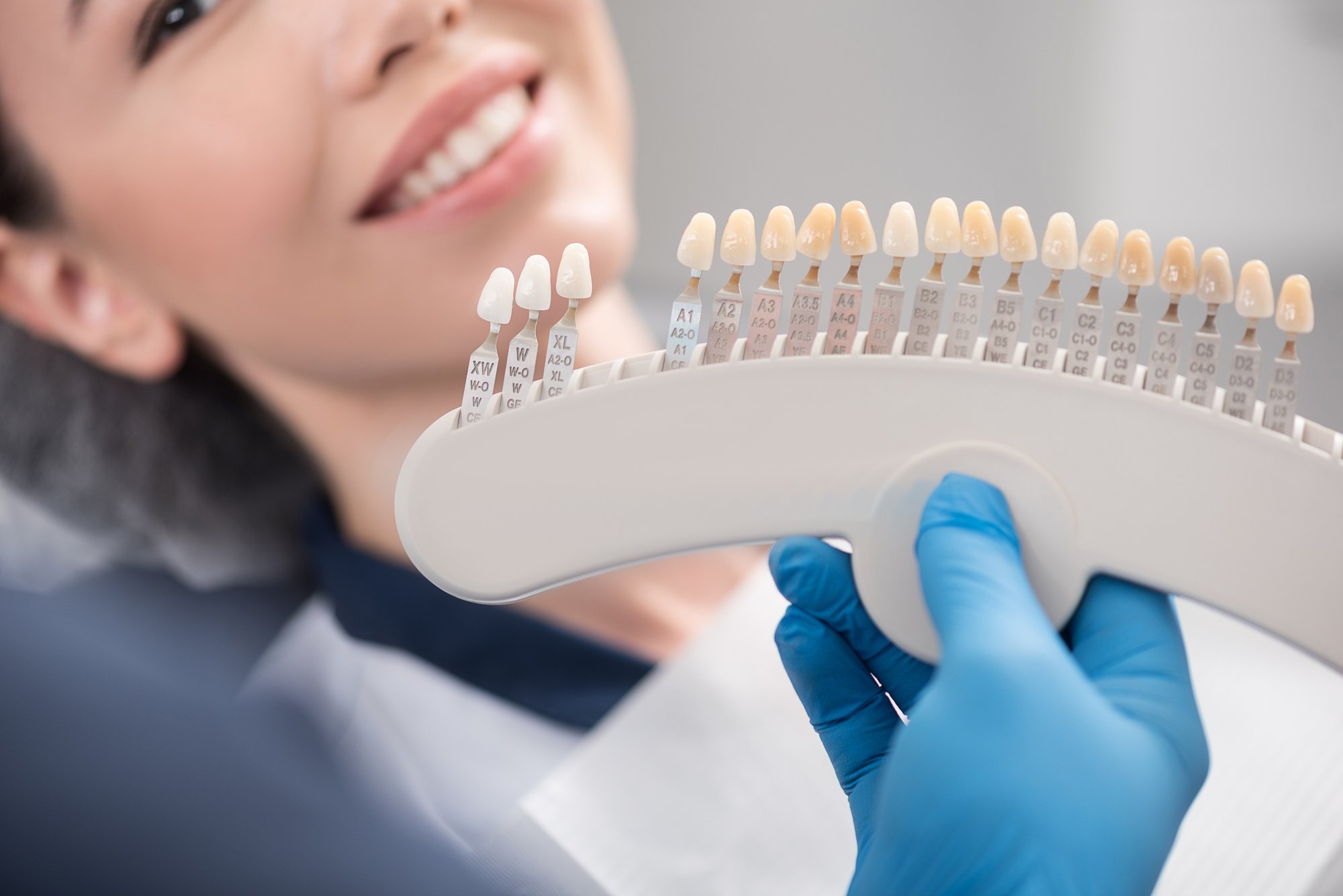 5 Things You Should Know Before Getting Your Teeth Prepped for Veneers ...