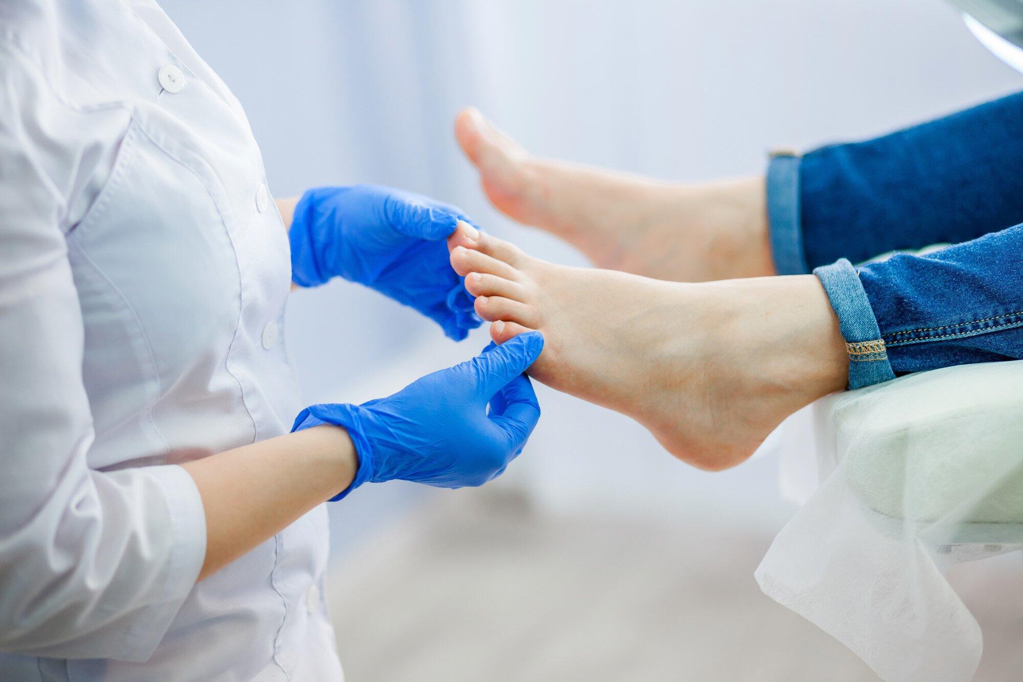 Why You Shouldn't Ignore a Toe Web Infection (What to Do About It)